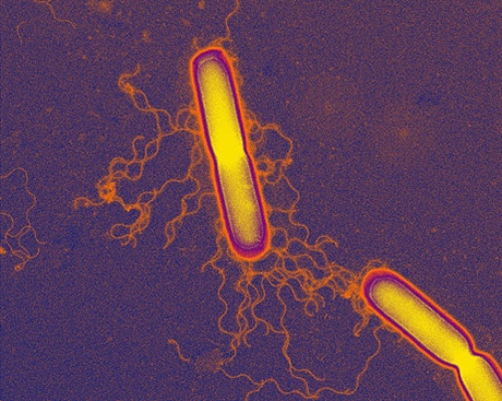 Researchers develop cocktail of bacteria that eradicates C.diff | News ...