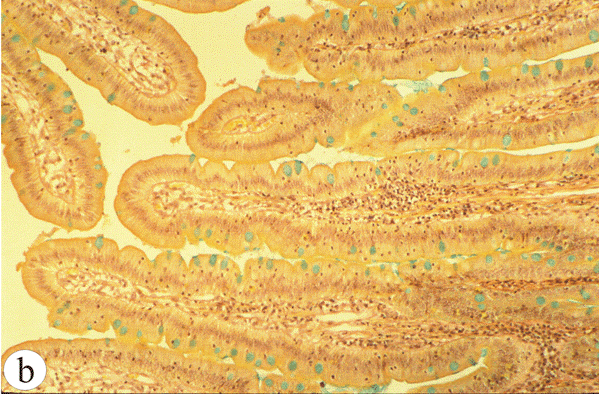 Small Intestine Villi Histology
