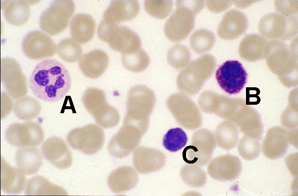 Lymphocyte Histology