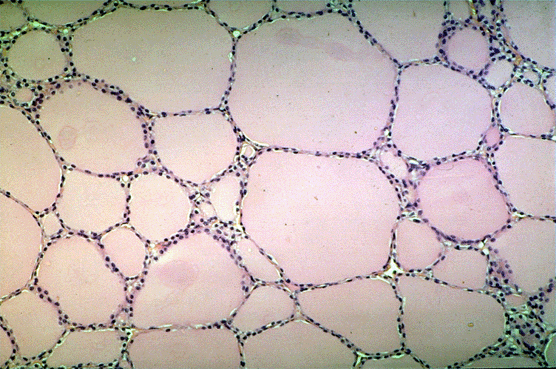 Normal Thyroid Histology