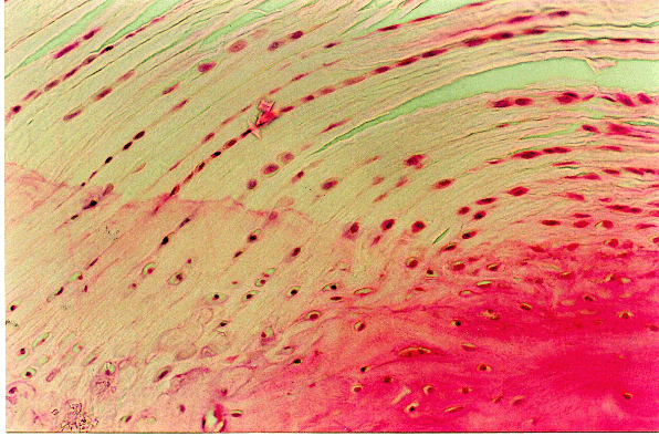 Fibrocartilage Connective Tissue Cartilage