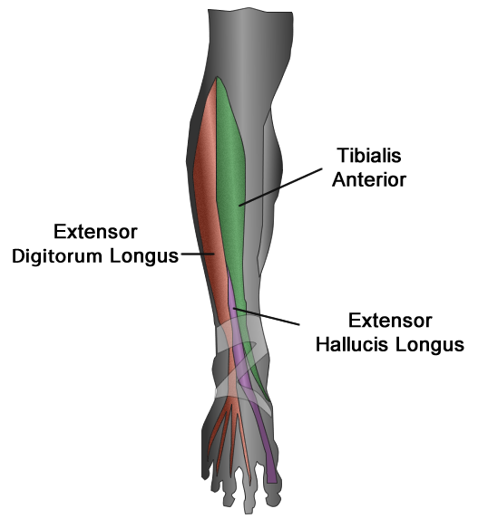 Acute Compartment Syndrome