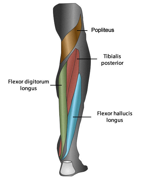 Deep Posterior Compartment Syndrome