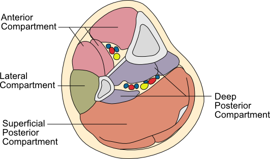 Above Knee Amputation Anatomy Above The Knee Amputation Guide