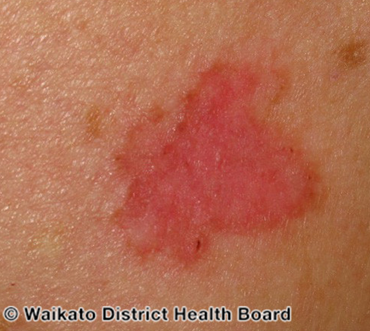 Dermatology Case Studies