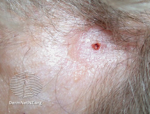 Dermatology Case Studies