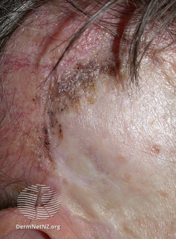 Dermatology Case Studies