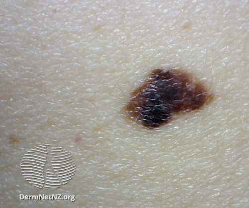 Dermatology Case Studies