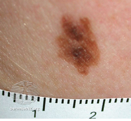 Dermatology Case Studies