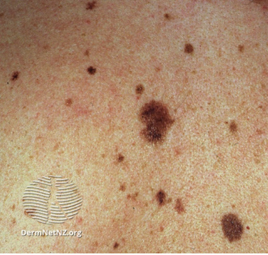 Dermatology Case Studies