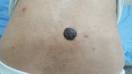 Dermatology Case Studies