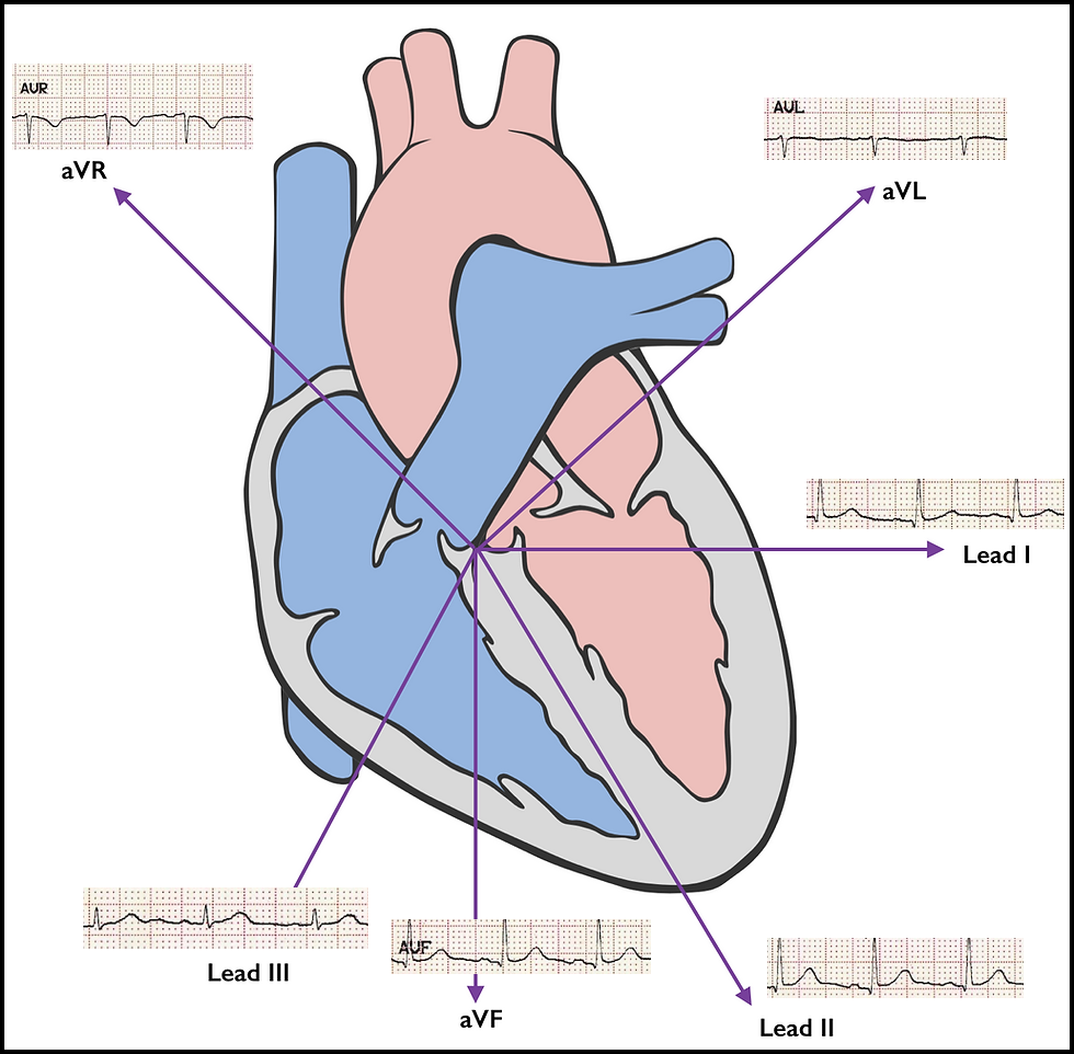 ECG Interpretation
