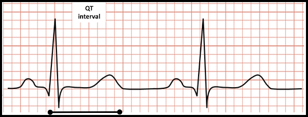 ECG Interpretation