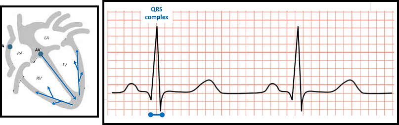 ECG Interpretation