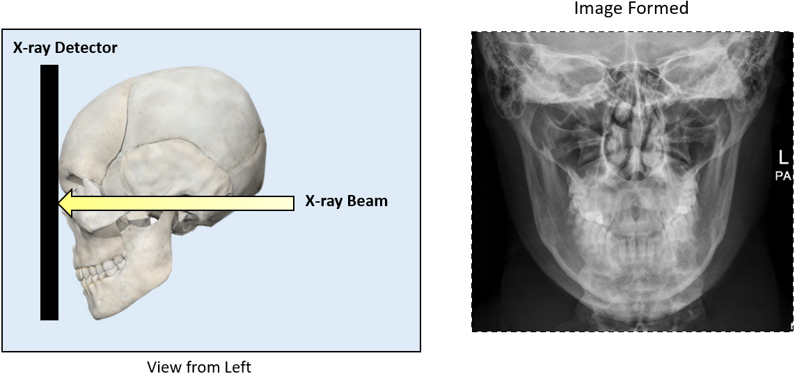 Identifying the Fractured Mandible