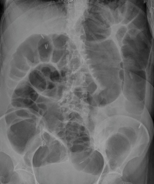Intravenous Fluid Therapy - Virtual Ward Round