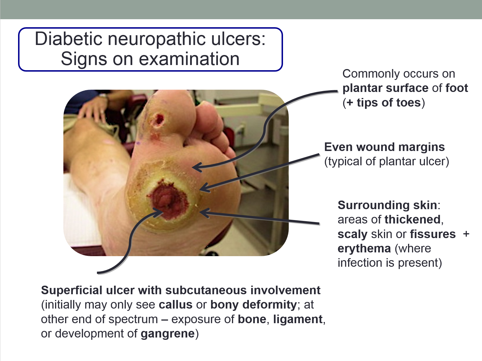 Leg Ulcers and Pressure Sores 3