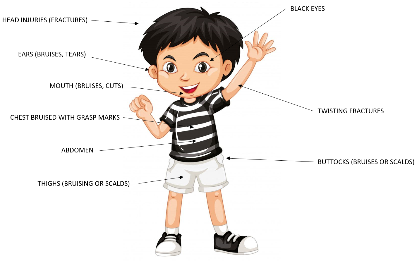 Non-accidental Injury in Paediatrics