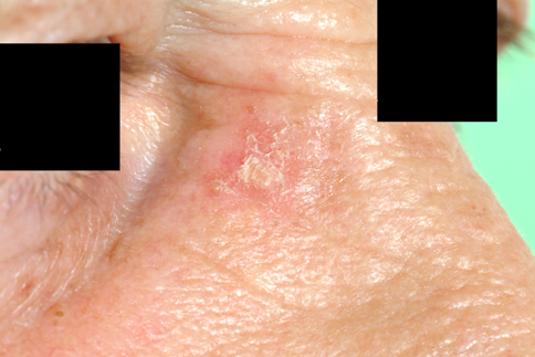 Skin Lesions Encyclopaedia