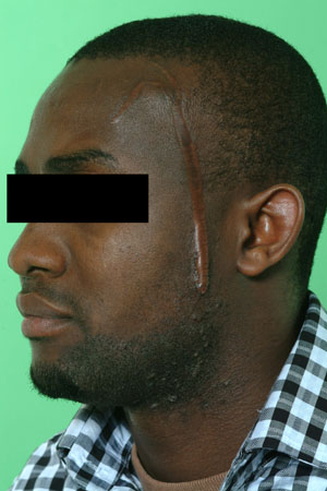 Skin Lesions Encyclopaedia