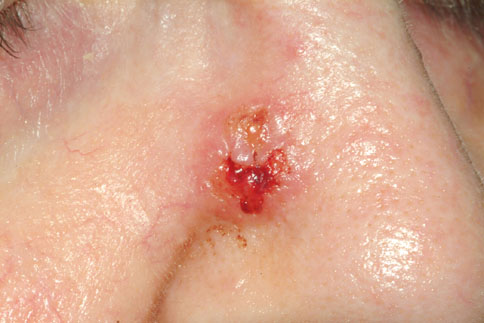 Skin Lesions Encyclopaedia