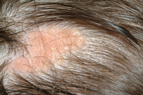 Skin Lesions Encyclopaedia