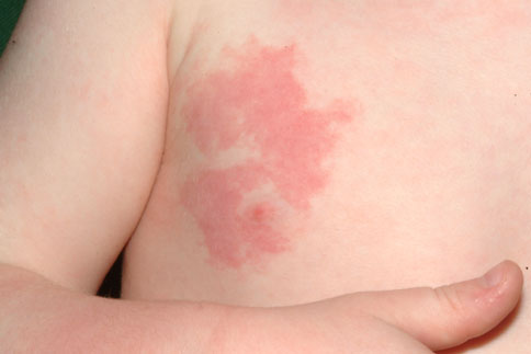 Skin Lesions Encyclopaedia