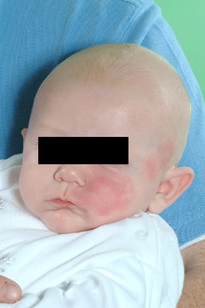 Skin Lesions Encyclopaedia