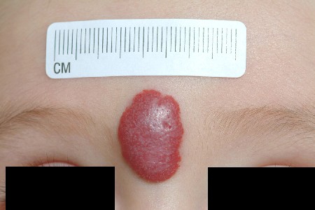 Skin Lesions Encyclopaedia