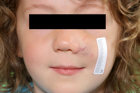 Skin Lesions Encyclopaedia