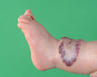 Skin Lesions Encyclopaedia