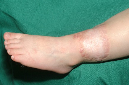 Skin Lesions Encyclopaedia