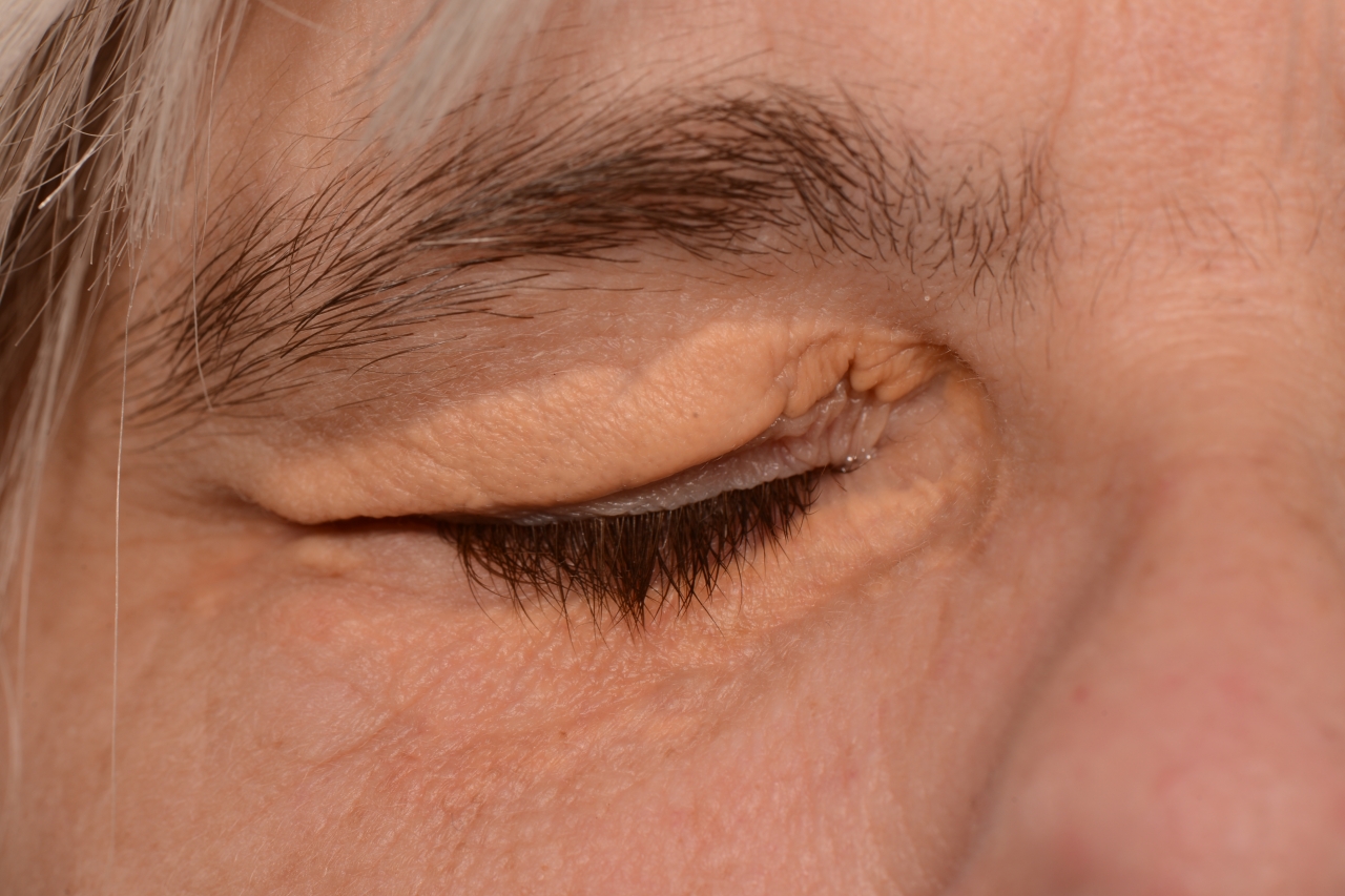 Skin Lesions Encyclopaedia
