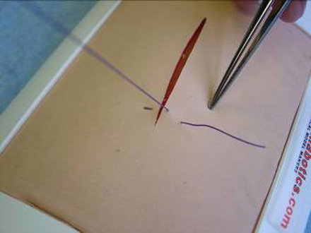 Figure 19: Vertical mattress suture.