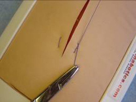 Surgery Simple Suturing For Gps