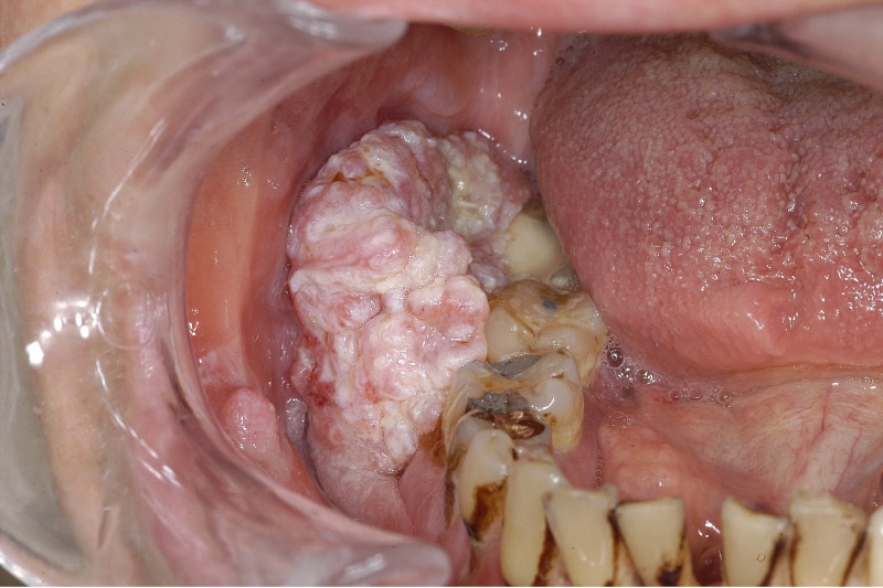 The Oral Cavity
