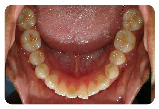 The Oral Cavity