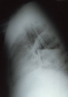 Lateral view radiograph