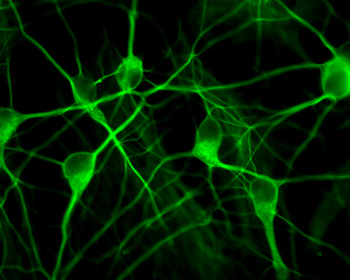 Cannabis compound can help cells | News | The University of Aberdeen